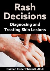 Rash Decisions: Diagnosing and Treating Skin Lesions