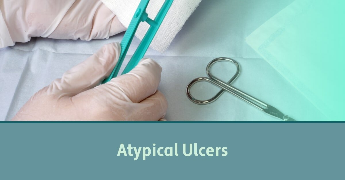 Atypical Ulcers
