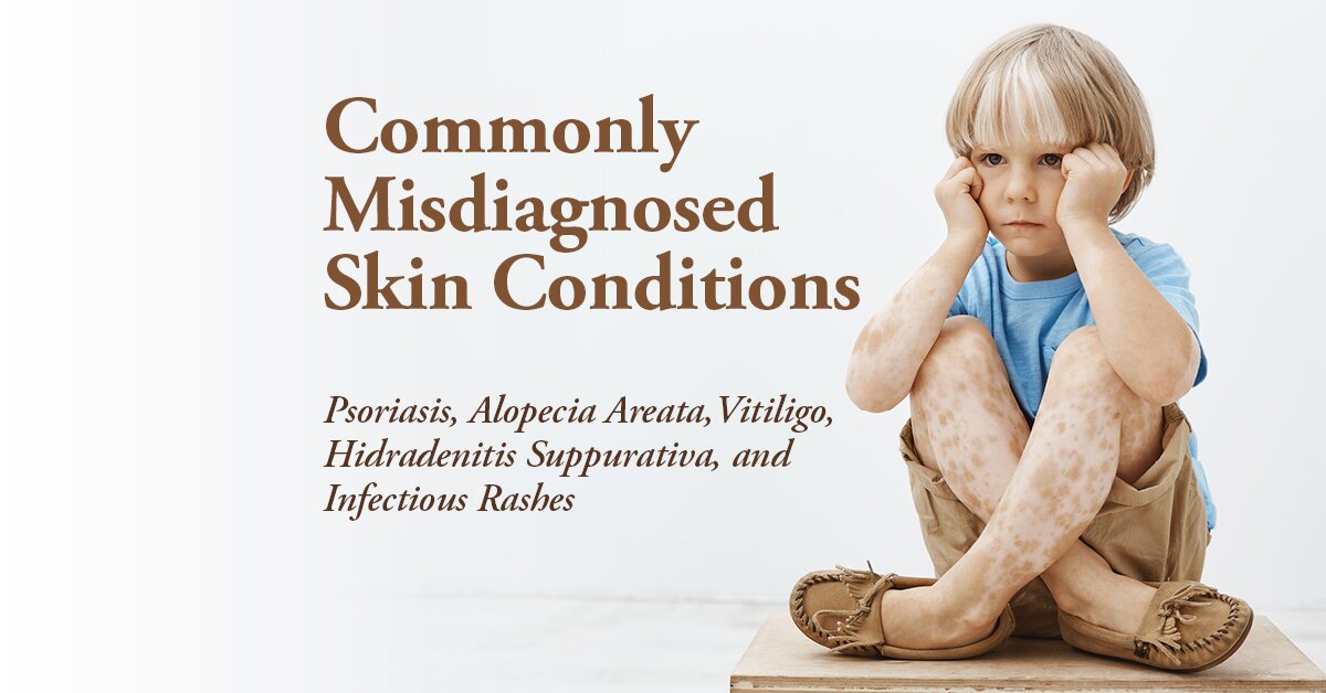 Commonly Misdiagnosed Pediatric Skin Conditions: Psoriasis, Alopecia ...